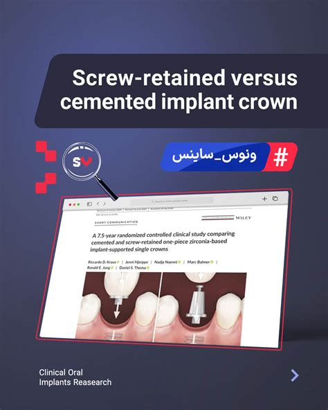 بلاگ شایگان ونوس ایرانیان