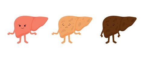 A Healthy Liver Nonalcoholic Fatty Liver Disease Cirrhosis Reversible And Irreversible Stages