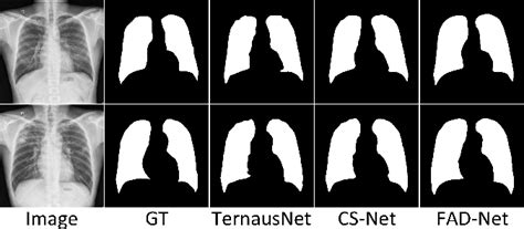 Figure 1 From A Real Time Multi Task Framework For Guidewire