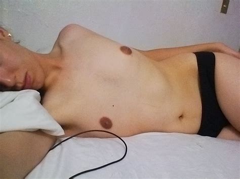 Orchiectomy Scarlett Pixl Castrated Shemale No Balls Balls Free Photo 22