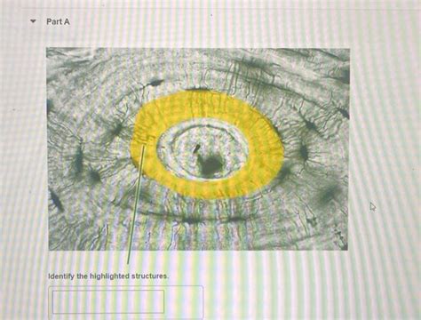 Identify The Highlighted Structures