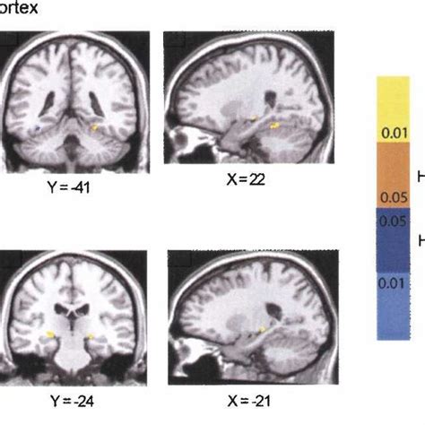 Brain Regions Showing Hit Vs Cr In The Associative Recognition Task Download Scientific