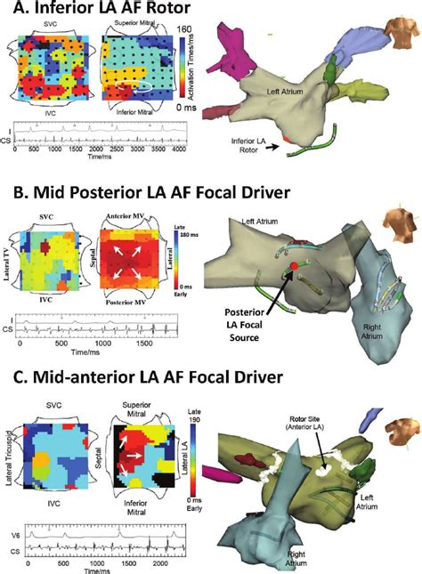 Focal Impulse And Rotor Modulation Firm Mapping Reveals Rotors And Download Scientific