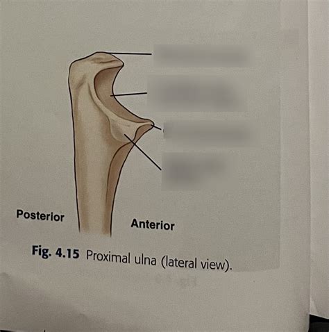 Image Analysis Proximal Ulna Diagram Quizlet