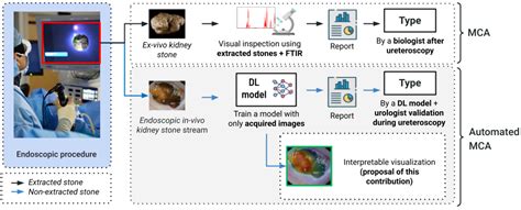 Improving Prototypical Parts Abstraction For Case Based Reasoning Explanations Designed For The