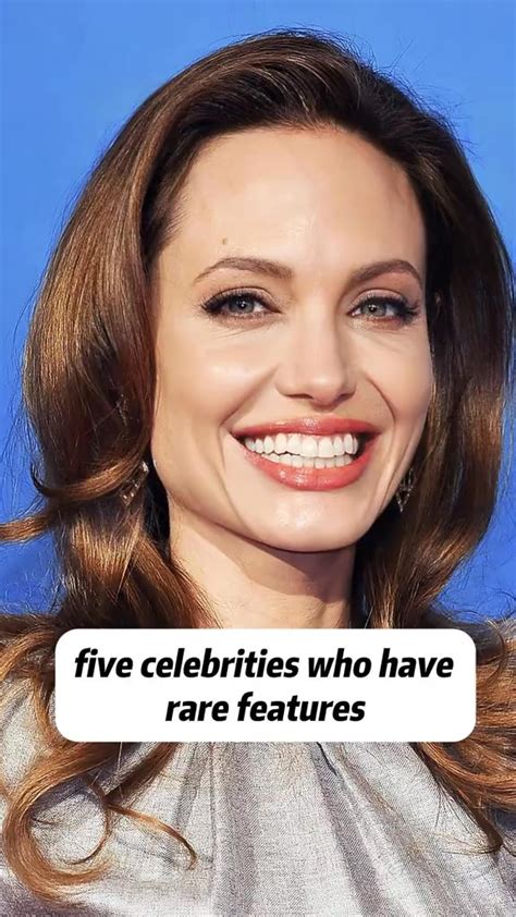 5 Celebrities Who Have Rare Features The Last One Is The Most