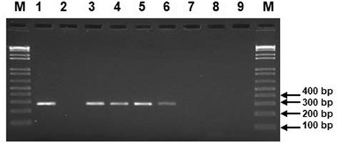 Products Of The Species Specific C Auris Pcr Positive Amplification