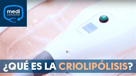 ¿qué Es La Criolipólisis Mediconsultas Youtube