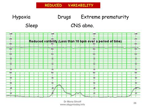 Ppt Ctg Interpret With Care Powerpoint Presentation Free Download Id 172108
