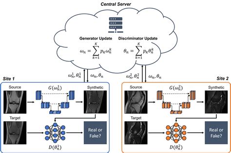 Improving Multi Center Generalizability Of Gan Based Fat Suppression