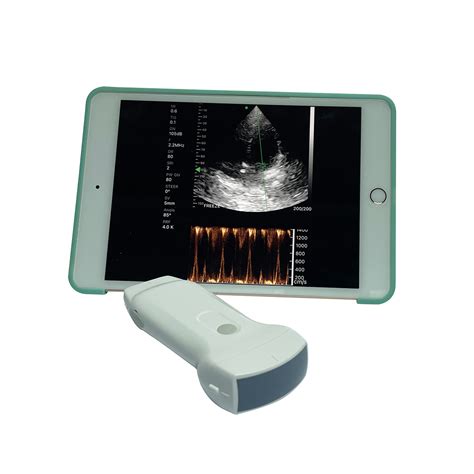 Wireless Android Ultrasound Probe WiFi USB Ultrasound Convex Linear Phased Array Doppler Probe