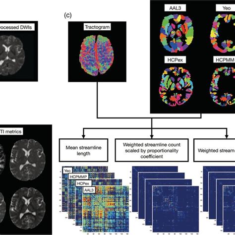 Idio Provides The Preprocessed Dwis With Dti Metric Maps And The Brain