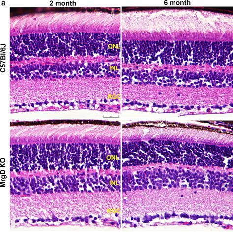 Evaluation Of Retinal Structure And Visual Function By Hande Histology