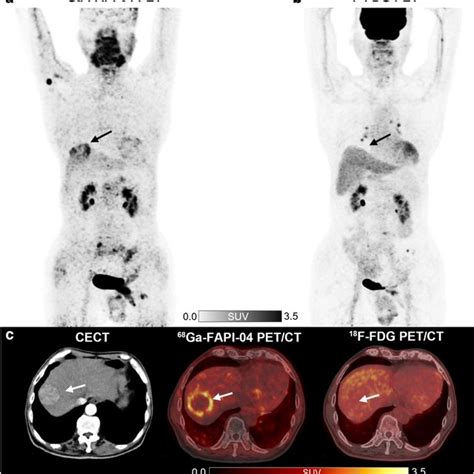 Structures Of Representative Fapi Based Tracers Used In Preclinical And Download Scientific