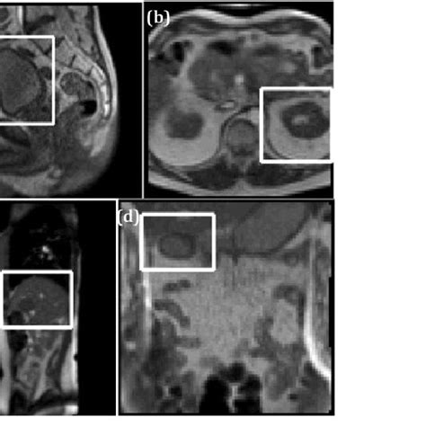 Comparison Of The Bladder Segmentation Of A Sample Image Frame Using Download Scientific