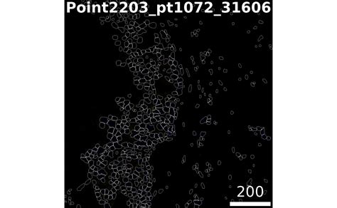 Performing A Spatial Analysis Of Multiplexed Tissue Imaging Data • Spicyworkflow