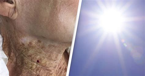 Striking Picture Shows Consequences Of 92 Year Old Woman Using