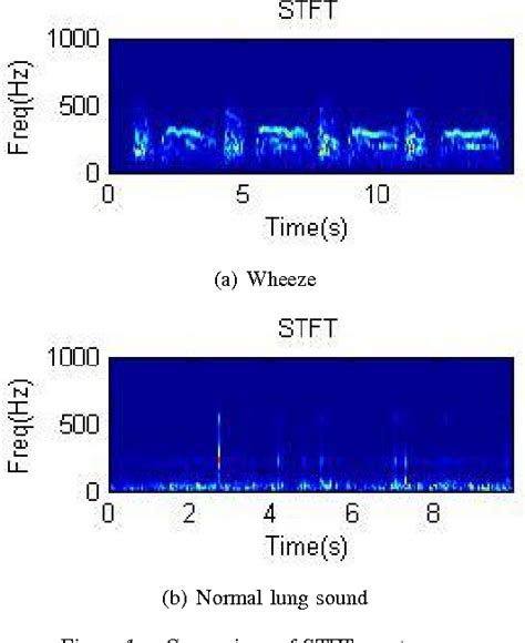 Figure 1 From Wheeze Detection Algorithm Based On Spectrogram Analysis Semantic Scholar