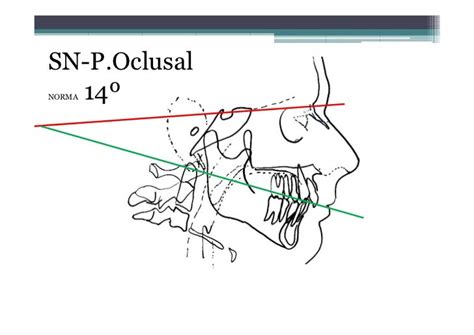 Cefalometria De Steiner