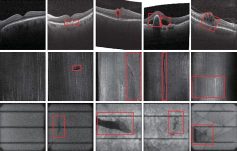 Figure 1 From Logit Inducing With Abnormality Capturing For Semi