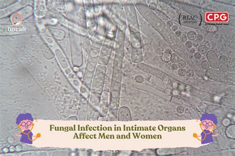 Fungal Infection In Intimate Organs Affect Men And Women