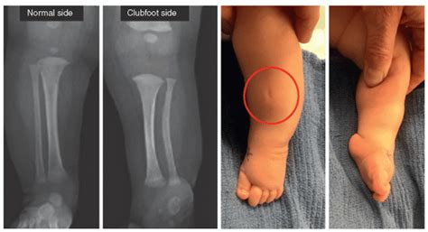 Leg Disorders Musculoskeletal Key