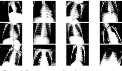 Figure 2 From Data Augmentation Using Auxiliary Classifier For Improved