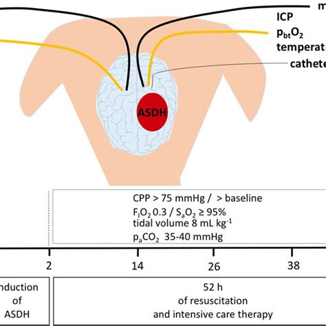 A Neurosurgical Instrumentation Via Craniotomy Above The Left And Download Scientific Diagram