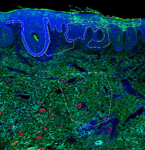 Multiomics Core Skin A Skin Biology Resource Center Uci Multiomics Core Skin A Skin Biology Resource Center Uci