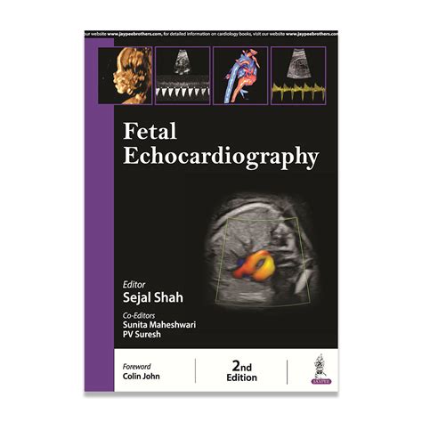 Buy Fetal Echocardiography 9789356966123