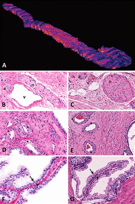 Open Top Light Sheet Microscopy Otls Images From 3d Pathology Data Download Scientific
