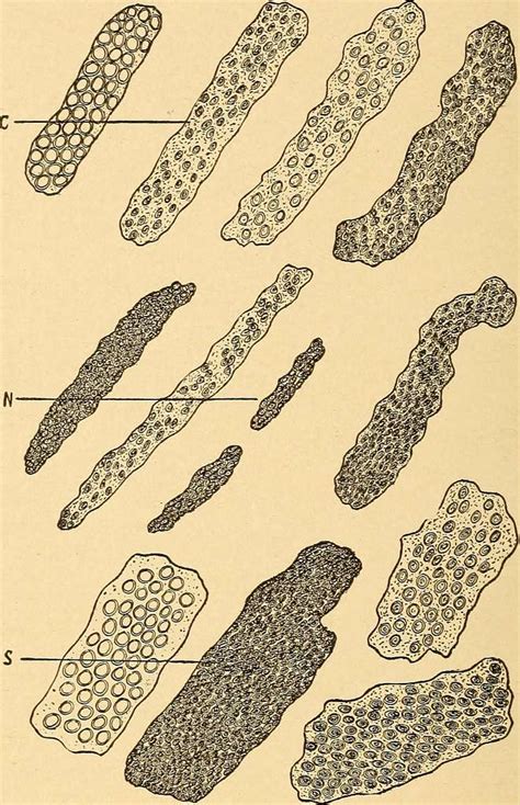 Urinary Analysis And Diagnosis By Microscopical And Chemical Examination 1906 14784460432