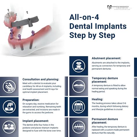 Implant Placement Best Dental Implants With Guided Tooth Implant