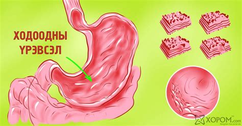 Энэ 5 жорыг мэдэж авснаар 10 хоногийн дотор цээж хорсох зовиураас салж