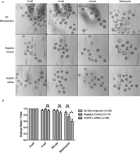 The Development Of Mice Preimplantation Embryos After Huwe1 Sirna