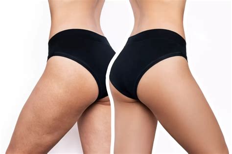 Buttock Enhancement Body Ladensitae Cosmetics