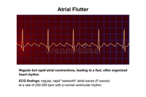 Regular Contractions Stock Illustrations 22 Regular Contractions