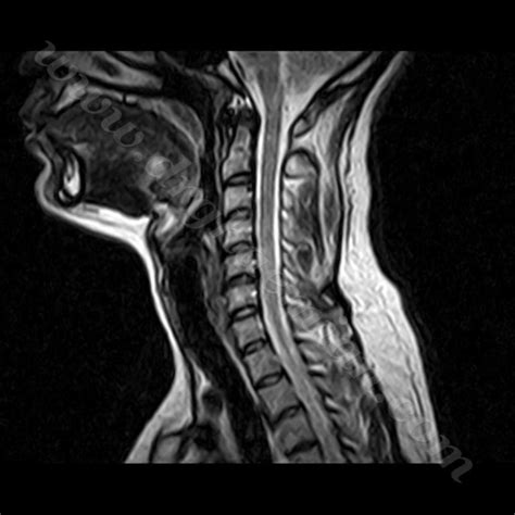 ام آر آی گردن چیست و چرا انجام می شود؟ مرکز تصویربرداری دکتر قائمیان