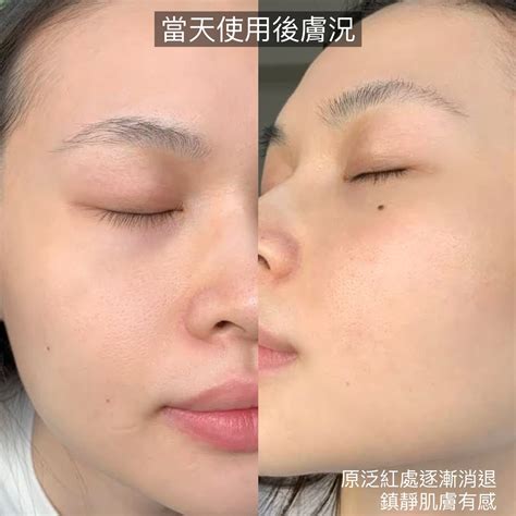 Sk Ii Dcard