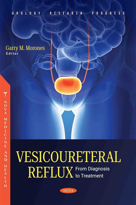 Vesicoureteral Reflux From Diagnosis To Treatment