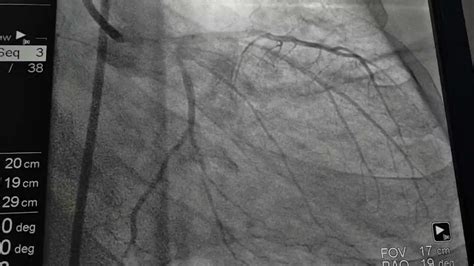 Jeevanraj R P Posted On Linkedin