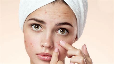 Skin Care Tips And Precautions For Face Beauty Protect Skin From Acne