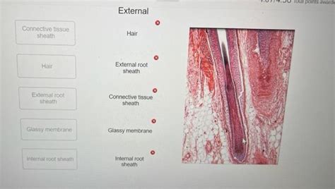 Glassy Membrane Internal Root Sheath