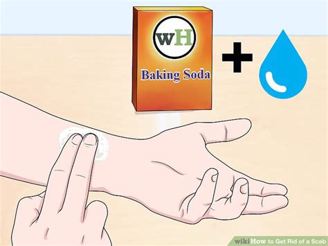 How To Get Rid Of A Scab 9 Steps With Pictures WikiHow