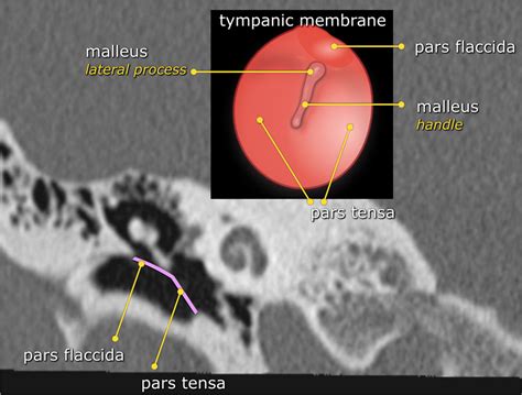 Applied Anatomy Of Tympanic Membrane Epomedicine