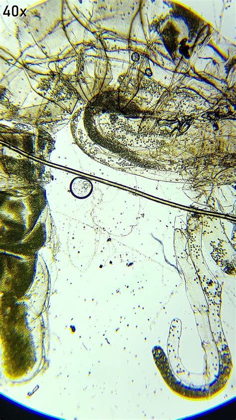 Please Microbe And Organism Identification R Microscopy