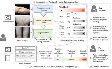 Artificial Intelligence Based Psoriasis Severity Assessment Real World