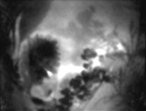 Dislocation Of Intimacy