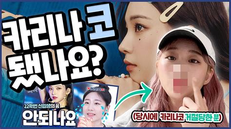 에스파 카리나 코처럼 성형 됐을까요 22학번 새내기 코성형 상담하고 유튜브 데뷔한 썰 네이버 Tv