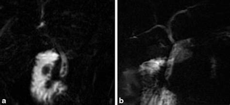 Ercp In Pregnancy Abdominal Key